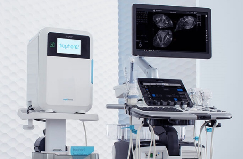 Nanosonics to more than double its manufacturing capacity with ...