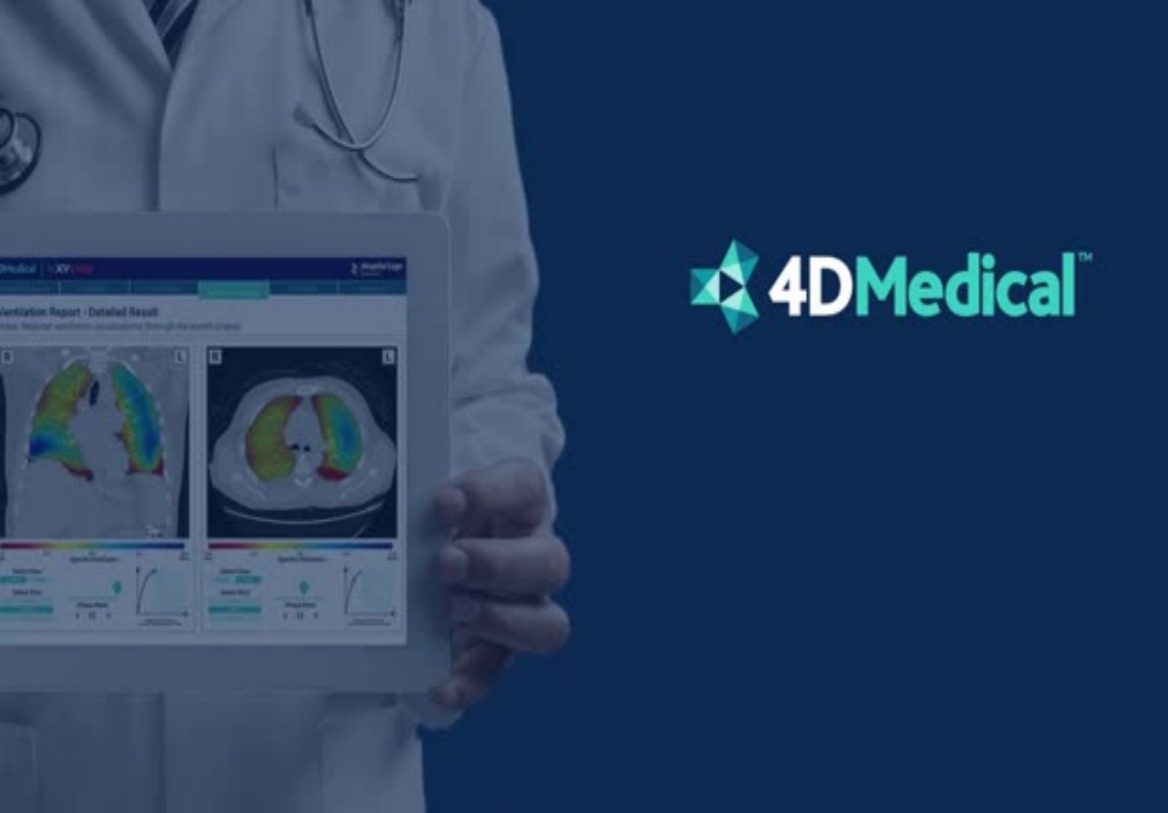 4DMedical completes $20m placement for respiratory imaging platform ...