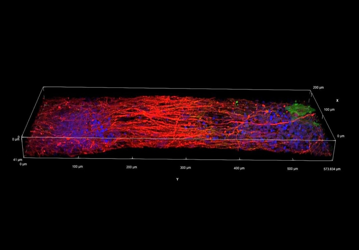 UW-Madison researchers unveil 3D-printed functional human brain tissue ...