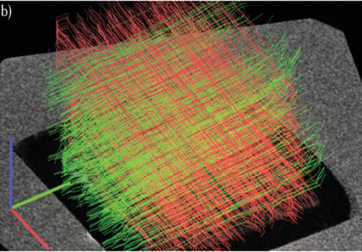 Scientists develop 3D-printed 'brain phantom' for MRI research ...