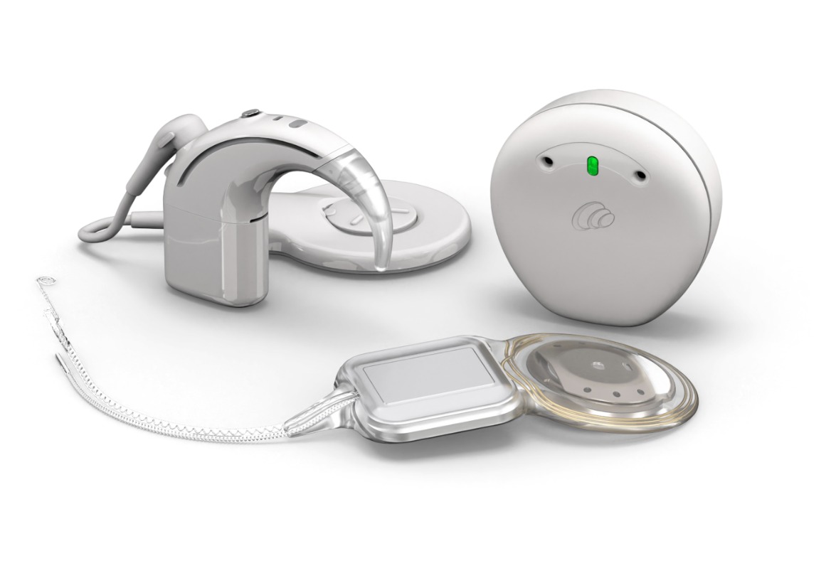 Cochlear launches smart hearing implant system developed in Australia ...